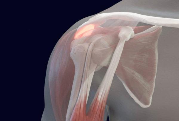 Shoulders > The Fabulist Words & Art